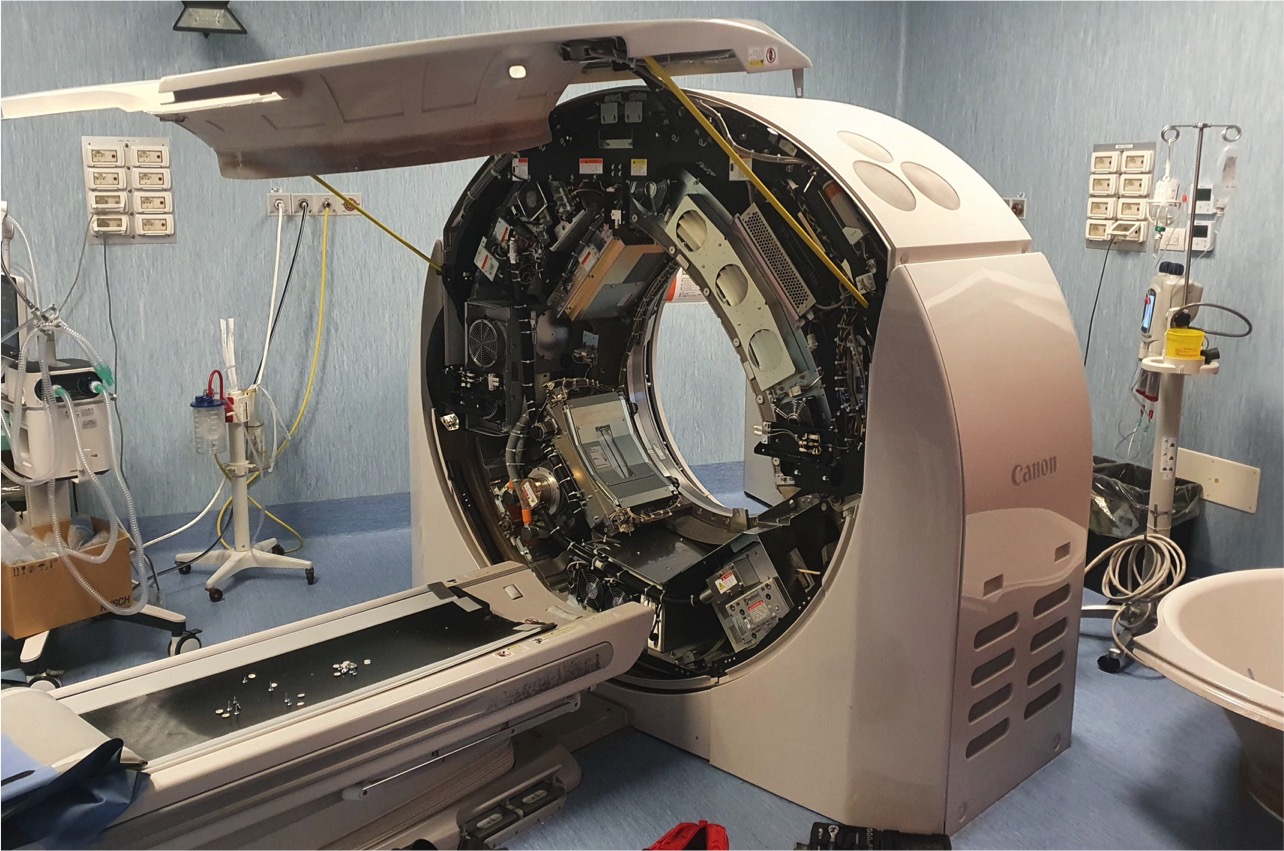 TC - Tomografia computerizzata - Radiologica